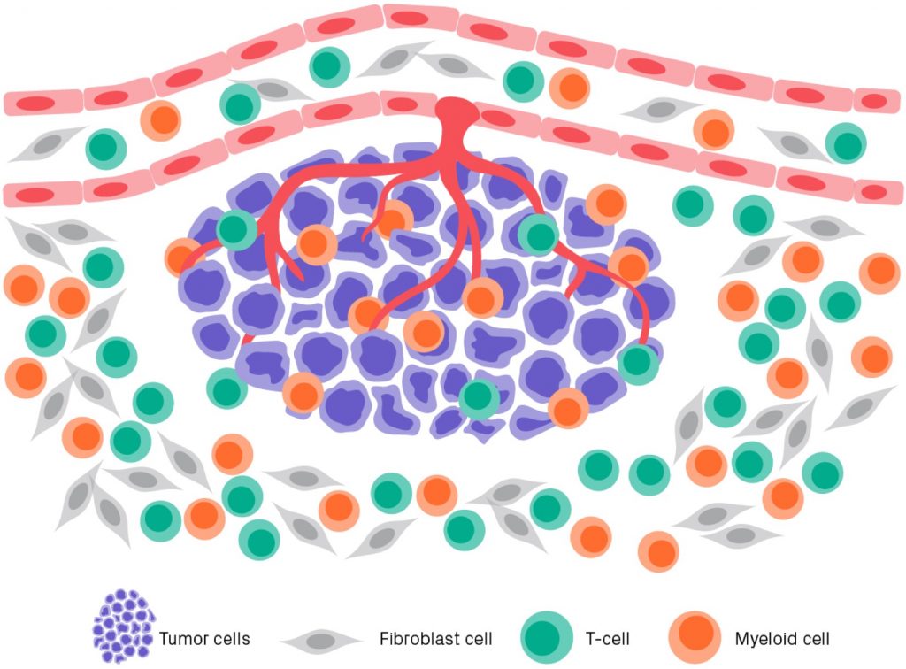 The Tumor Microenvironment: How to Break Through | Parker Institute for ...